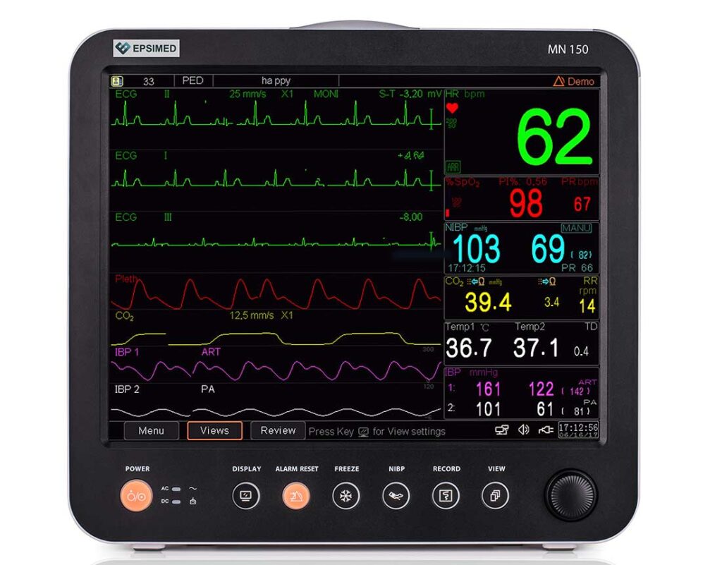 Different types of vital signs monitors and their different uses - Epsimed